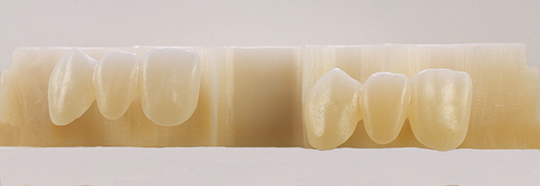 Rethinking Zirconia | Inside Dental Technology