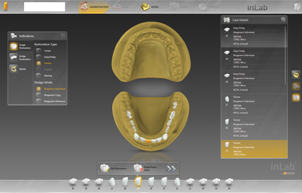Dentsply Sirona’s inLab® System: Versatile Digital Solution | Inside ...
